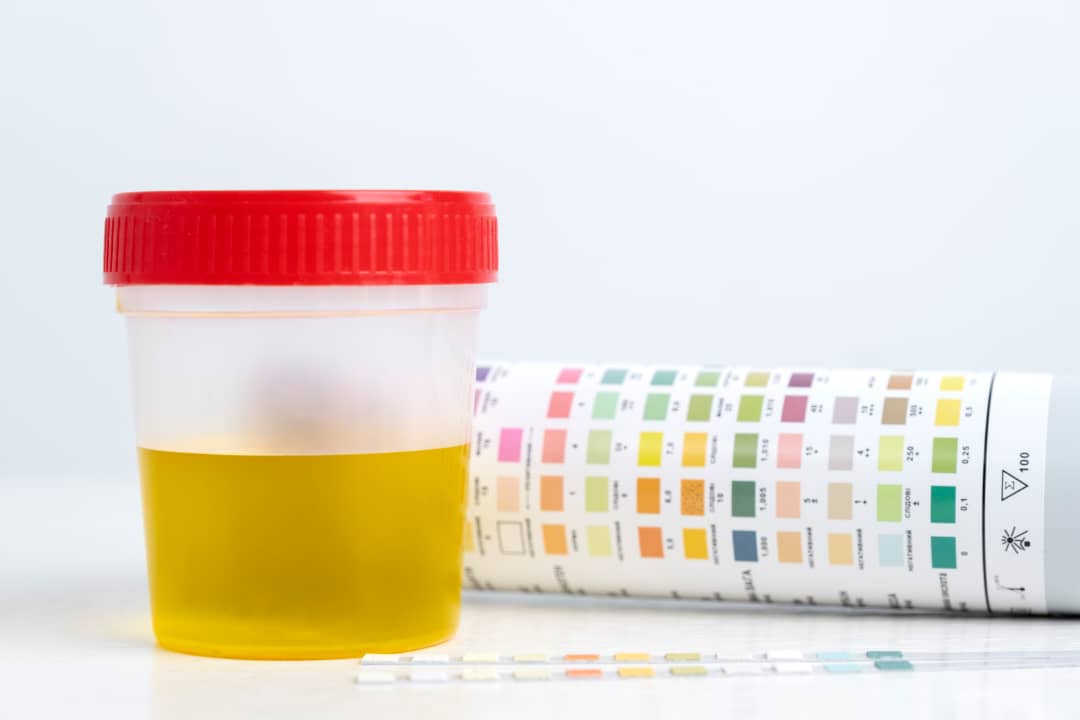 Urine color indications on your health - IHMO