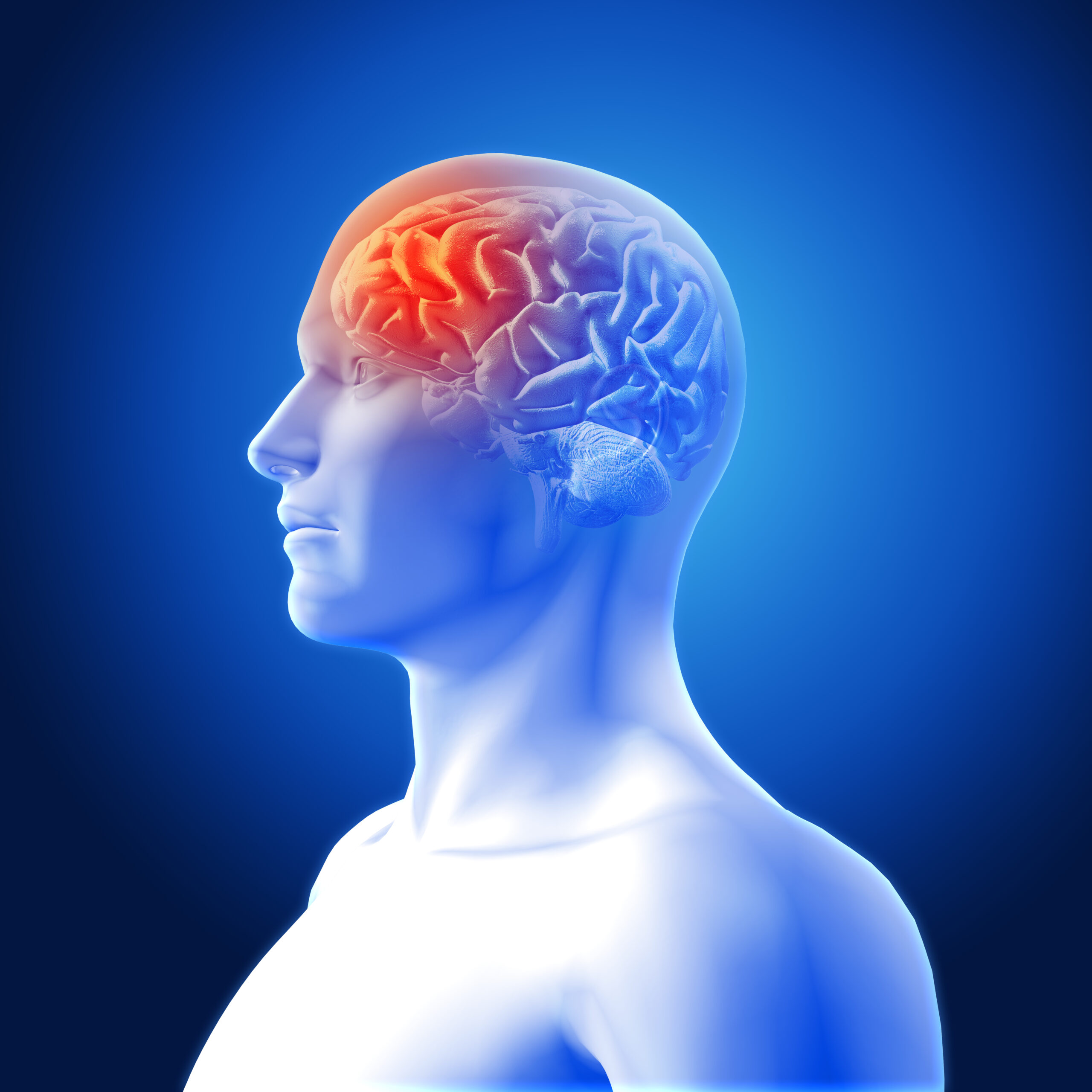 Brain Atrophy - IHMO